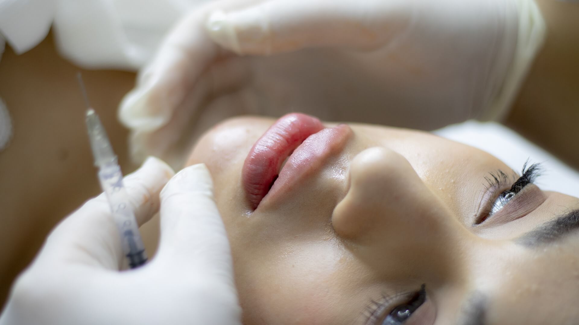Are Fillers Right for Me? 7 Things to Consider | Jefferson Facial Plastics